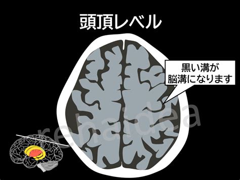 脳画像から一次体性感覚野3 1 2野を探す方法とは リハアイデア