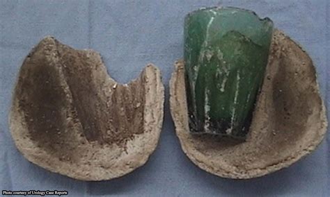 Ginawang Sex Toy Baso Pumasok Sa Ari Ng Bebot