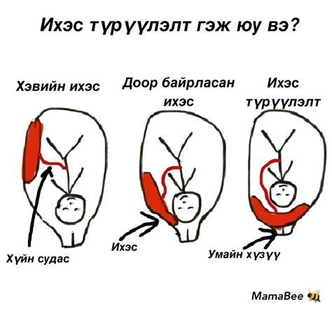 Mamabee 🐝Ихэс түрүүлэлтийн талаар ярихын тулд ихэс гэж гэж юу вэ гэдэг талаар багахан мэдээлэл