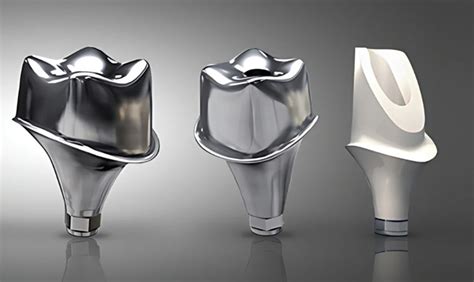 Tại Sao Những Người Mặt Vuông Quai Hàm Lớn Nên Dùng Abutment Cá Nhân Hóa