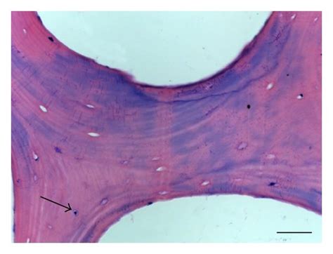 Af Histological Analysis Of Native Cancellous Bone Ncb And Download Scientific Diagram