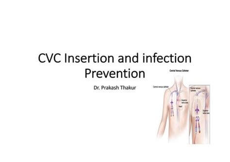 Care Of Cvp Line Pptx First Aid Injuries
