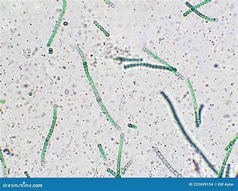 Nostoc Sp Algae Under Microscopic View Cyanobacteria Blue Green