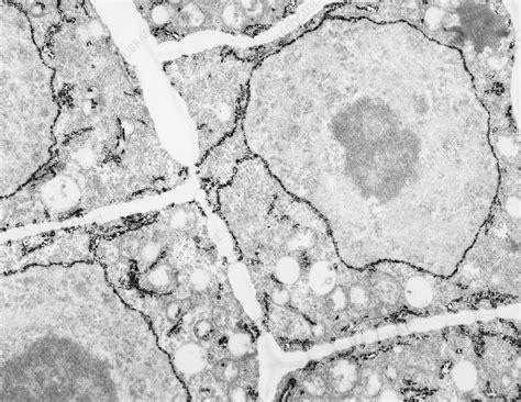 Ribosomes Microscope