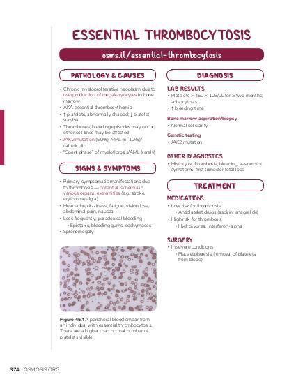 Leukemoid Reaction Video Causes And Meaning Osmosis