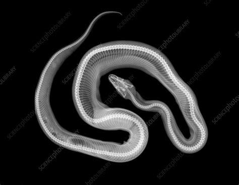 Python X Ray Stock Image C0374692 Science Photo Library