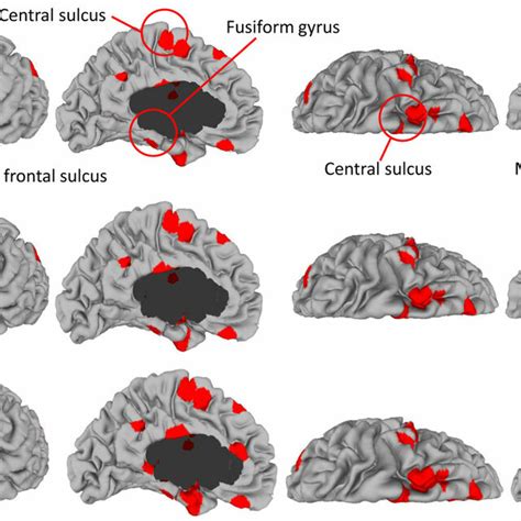 Our Approach Consists Of 3 Main Steps Tetrahedral Mesh Generation Download Scientific Diagram