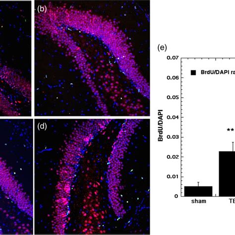 Brdu Neun Double Staining Images And Analyses At The Neurogenic