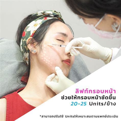Botox 200 Unit ทำส่วนไหนบนใบหน้าได้บ้าง 👱🏻‍♀️ ลดขนาดกราม ปรับใบหน้า