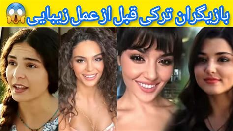 تصاویر قبل و بعد از عمل زیبایی بازیگران ترکی Youtube