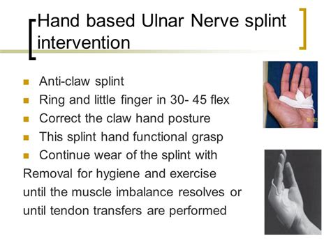 Radial Nerve Palsy 49 Off