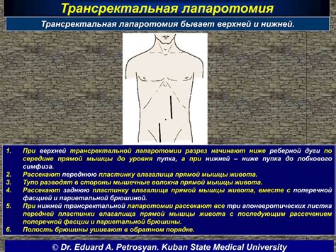 Лапаротомии презентация онлайн