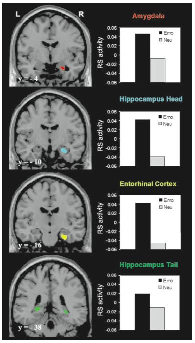 The Neural Correlates Of Emotional Memory Retrieval Emotion Brain And Behavior Laboratory