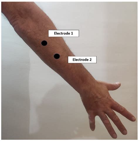 Electrode Placement Scheme For Extensor Muscles Download Scientific Diagram