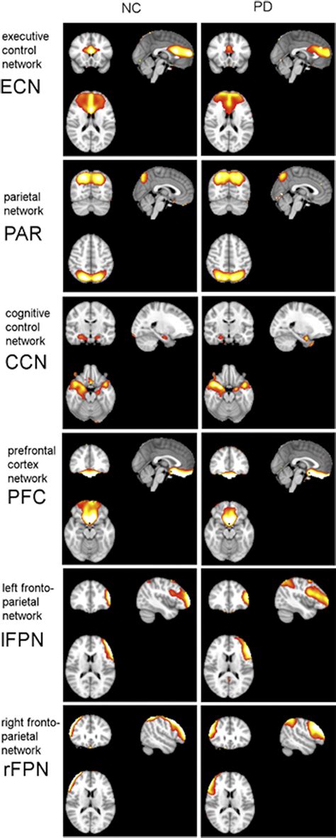 Six Ica Resting State Networks Show Different Spatial Patterns For Nc