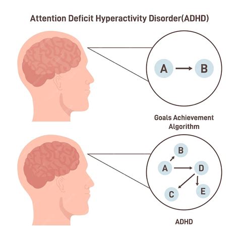 Premium Vector Adhd Brain Concept Attention Deficit Hyperactivity Disorder Way