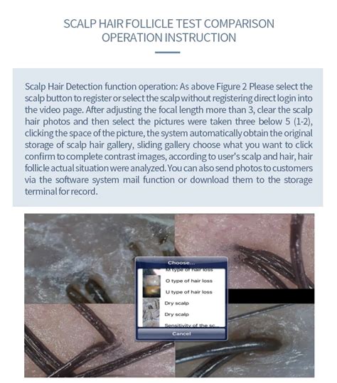 Wireless Scalp Hair Software Analyzer Hair Detection Analysis Camera Focus On Scalp Detector 13