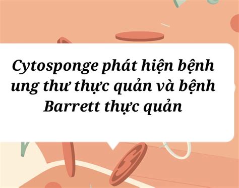 Cytosponge Phát Hiện Bệnh Ung Thư Thực Quản Và Bệnh Barrett Thực Quản