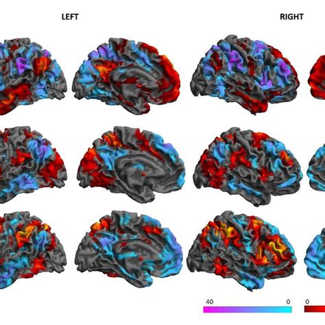 Functional Connectivity Patterns Of The Dlpfc Seed Regions Download