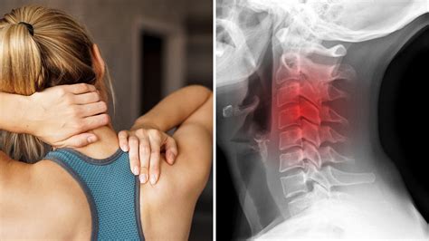 10 Exercises That Relieve Neck Pain Power Of Positivity
