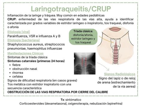 Laringotraqueitiscrup Alexa Rodriguez Udocz