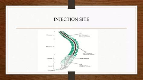 K Mohan Epidural Anesthesia Presentation Pptx