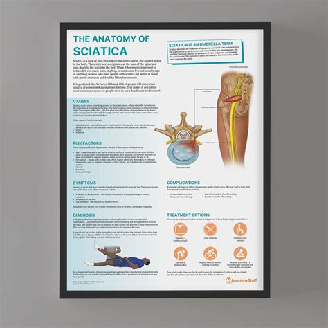The Anatomy Of Sciatica Chartposter Laminated Anatomystuff