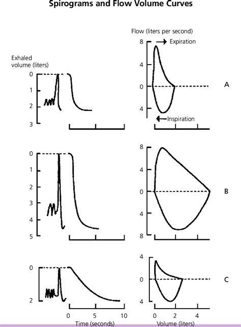 Obstructive Vs Restrictive Lung Disease Spirometry