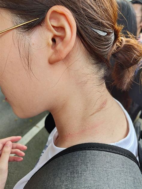 Kabilan Kandasamy On Linkedin Beng Hock Support Group Condemns Police Violence The Malaysian