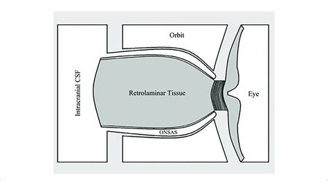 Relationship Between Optic Nerve Subarachnoid Space Onsas And The Download Scientific