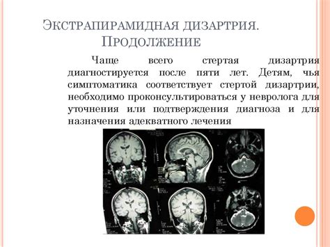 Дизартрия презентация онлайн