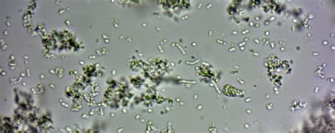 Lactobacillus Bulgaricus And Streptococcus Thermophilus Biological Microscope Observation — Hive