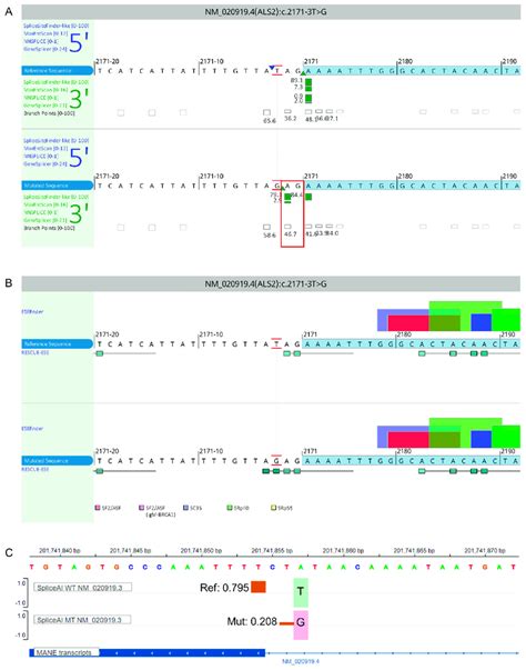In Silico Prediction Of The Als2 C2171 3tg Variant A In Silico