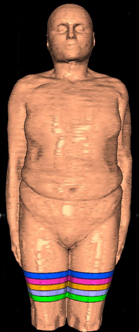 First French Experiences Of Total Body Irradiation Using Helical Download Scientific Diagram