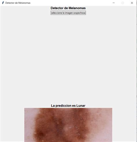 the image displayed in the gui moves down every time user selects a newone tkinter python