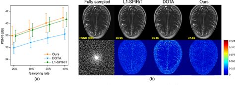 A Plug And Play Synthetic Data Deep Learning For Undersampled Magnetic