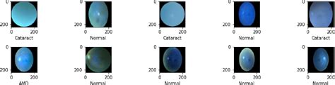 Figure 2 From Deep Learning Based Ocular Disease Classification In