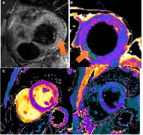 CMR Images The Balanced FFE Fast Field Echo Sequences Acquired Along