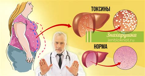 Детокс-напитки, сжигающие жир во время сна: дешевые коктейли очищают ...