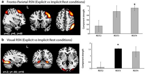 A The Figure Depicts Functional Connectivity Group Results For The Download Scientific Diagram