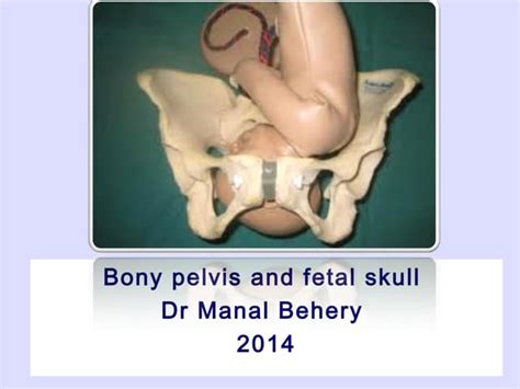 Classification Of Pelvis Pptx