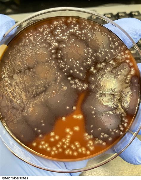 Microbenotes Pseudomonas Aeruginosa And Candida Albicans