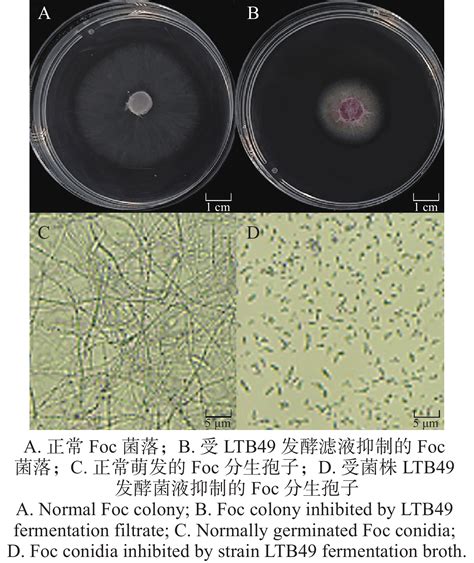 Biocontrol Potential Of Bacillus Subtilis Ltb49 Against Cucumber Fusarium Wilt