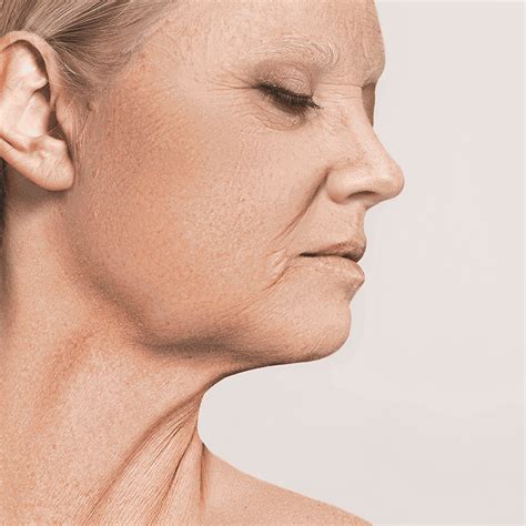 약손드림 보호대 저주파마사지기 Ems 안마기 웨어러블 반영구적 마사지 약손드림 Ems 저주파마사지기