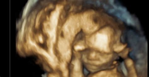 Did You Want To Find Out The Sex Of Your Baby Today S Parent