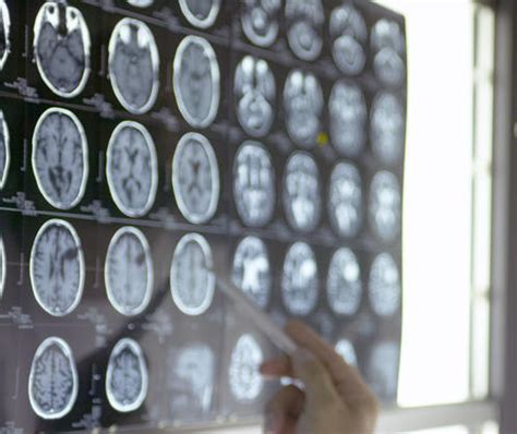 About Innovation Center On Sex Differences In Medicine