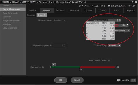 Temporal Resolution In Mri How To Calculate Temporal Resolution