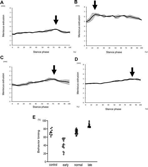 Three Patterns Of Waveforms Based On The Dynamics Of Mme And Its Peak
