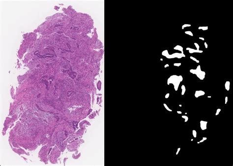 digipathai intel devmesh avinash kori 12 08 2019