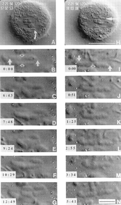Ve Dic Microscopy Of Chromosome Dynamics In Microinjected Cells The